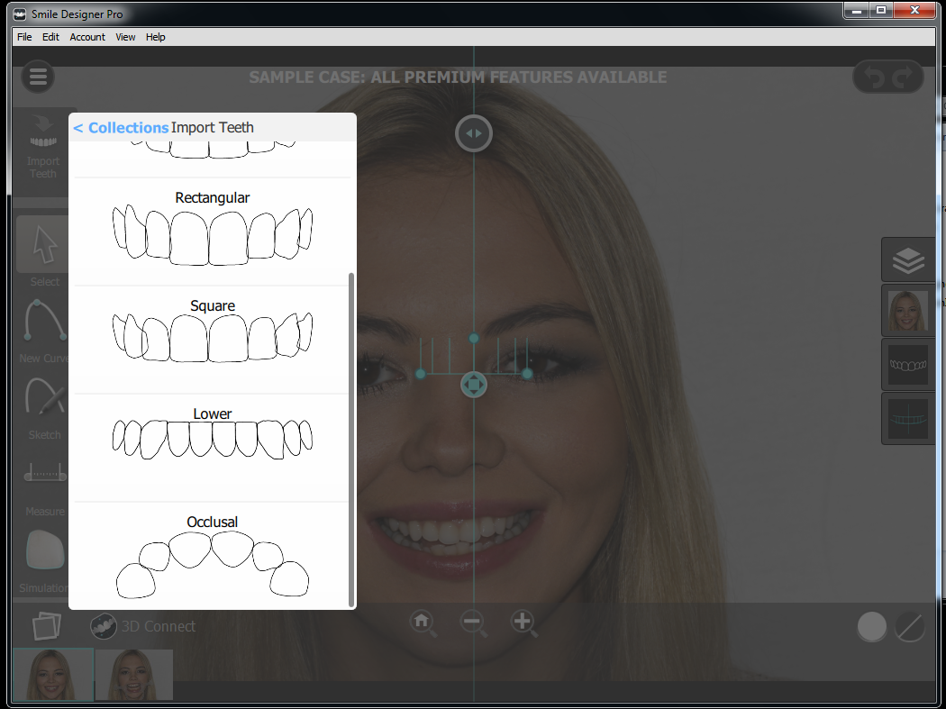 smile designer pro – Request a Crack
