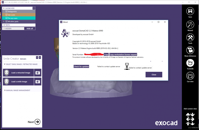 exocad DentalCAD 2.3 Matera crack – Request a Crack