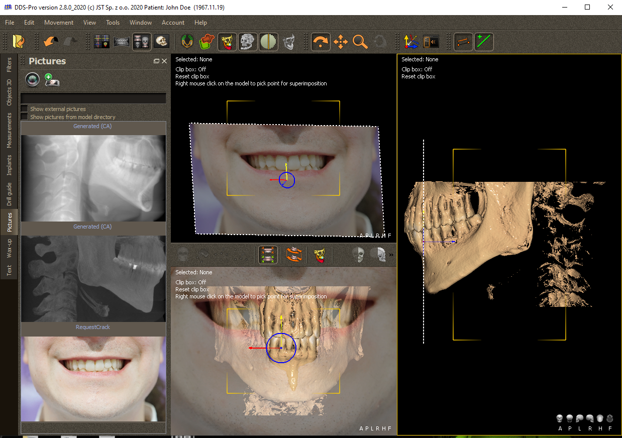Dds Pro Crack Request A Crack