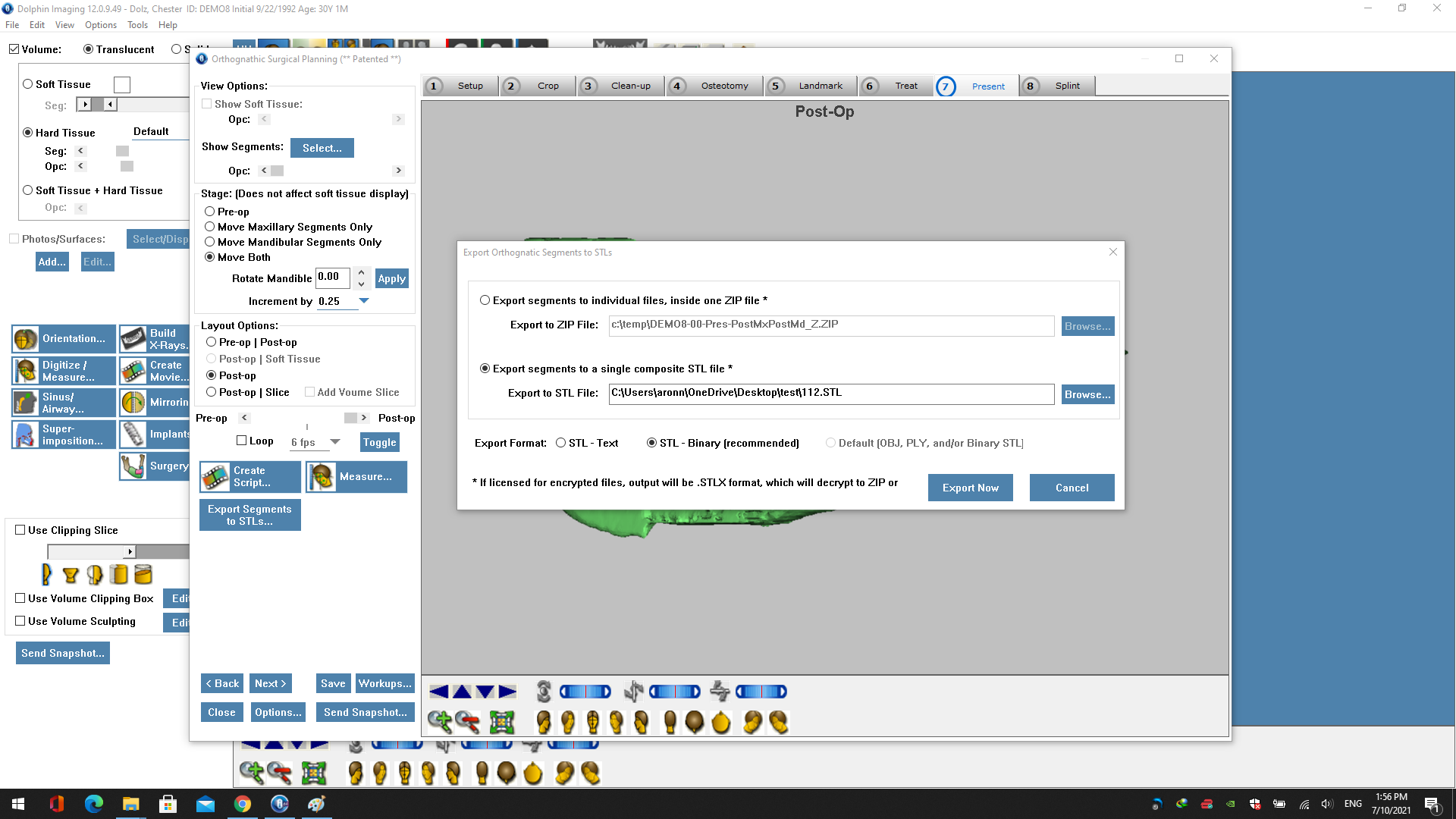 Dolphin Imaging 12 crack – Request a Crack