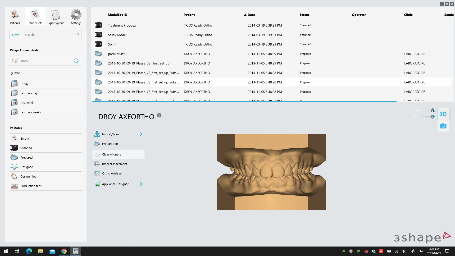 3Shape Ortho System 2021 crack – Request a Crack